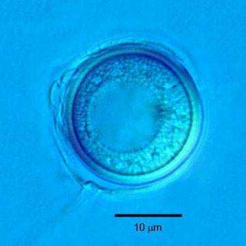 Recerca de Selenoproteïnes | Resultats i Discussió